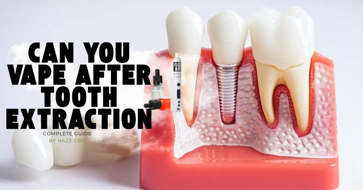 Can You Vape After Tooth Extraction? Dentist Guide 2025